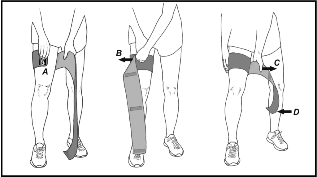 Three Reasons You Should Be Wearing Triple Stick Straps While Training ...