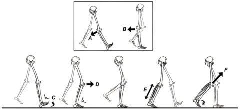 Gait Retraining for Knee Hyperextension - Human Locomotion