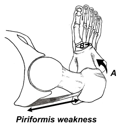 Hip Strength as a Percentage of Body Weight: Using a Modified ToePro ...
