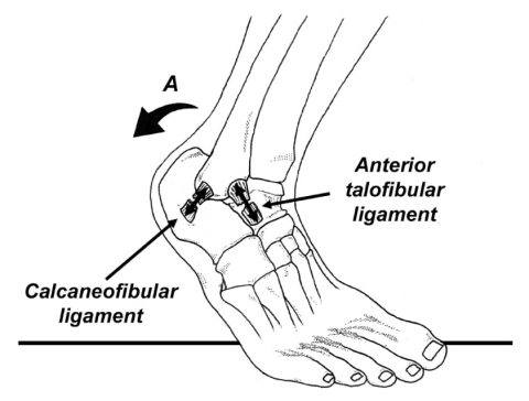 How to Rehab a Sprained Ankle - Human Locomotion