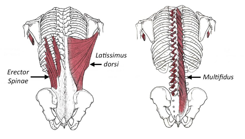 The Strong Connection Between Low Back Pain and Weak Multifidi (and the ...