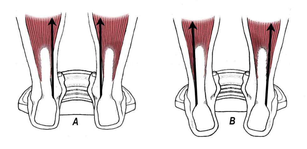 The Treatment and Prevention of Anterior Cruciate Ligament Injuries ...