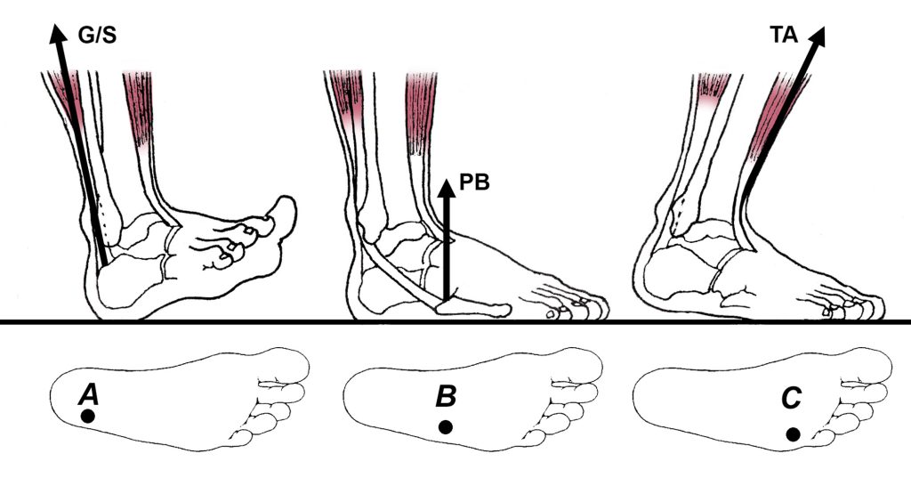 Balance ButtonsHow Stimulating Specific Locations on the Bottom of Your ...