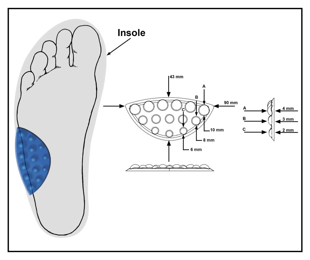 Balance ButtonsHow Stimulating Specific Locations on the Bottom of Your ...