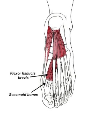 Managing Sesamoid Injuries - Human Locomotion