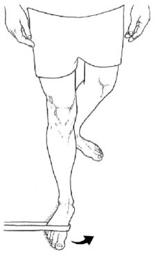 Popliteus Tendinitis: Biomechanical Factorsand Conservative Treatment ...