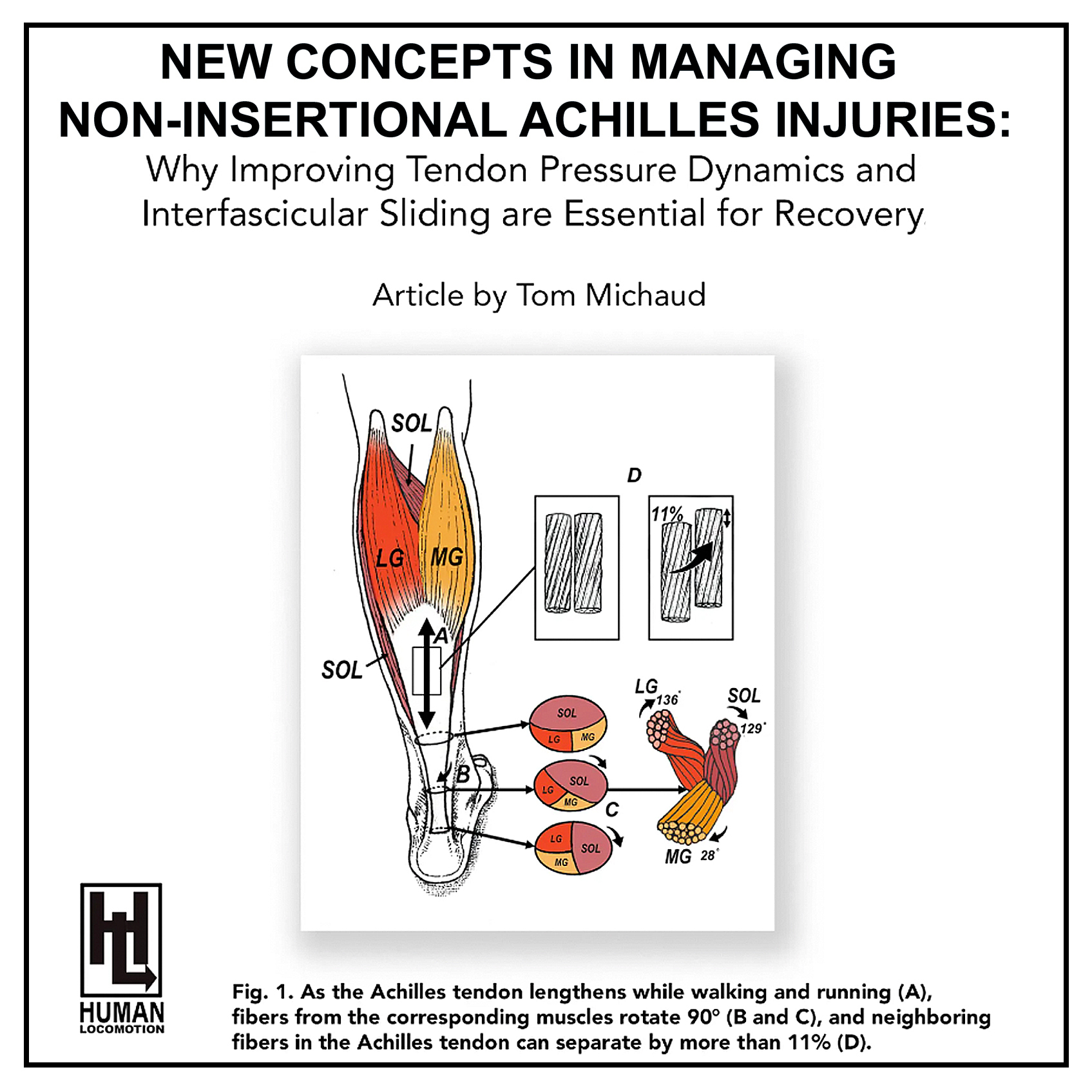 New Concepts in Managing Non-Insertional Achilles Injuries: Why ...
