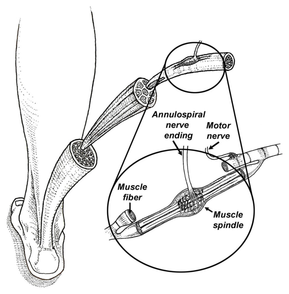 Focal Muscle Vibration: An Overlooked Tool for Diagnosing and Managing ...