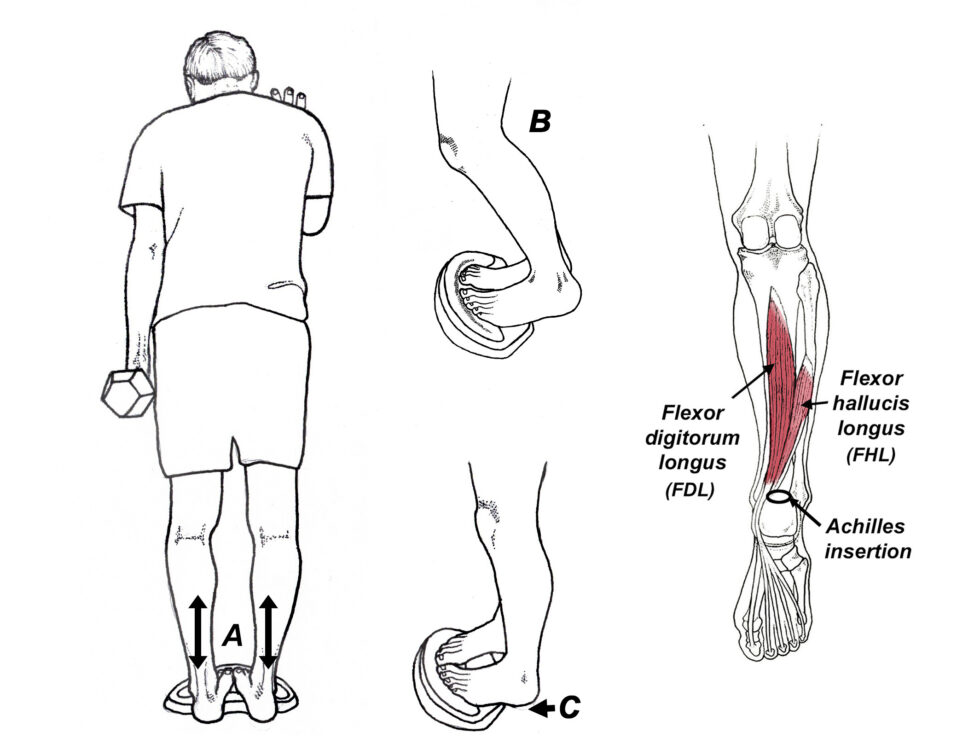 The Ideal Exercises for Managing Insertional Achilles Injuries - Human ...
