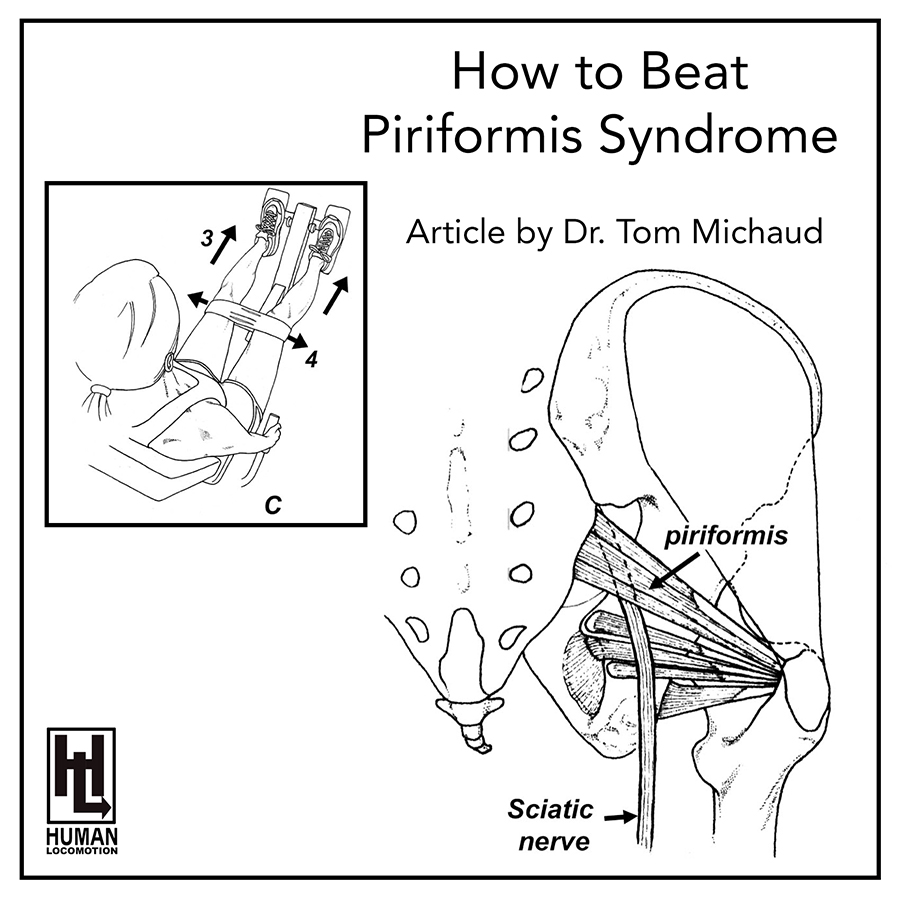 Stationary Bike And Piriformis Syndrome at Anita Mcguire blog