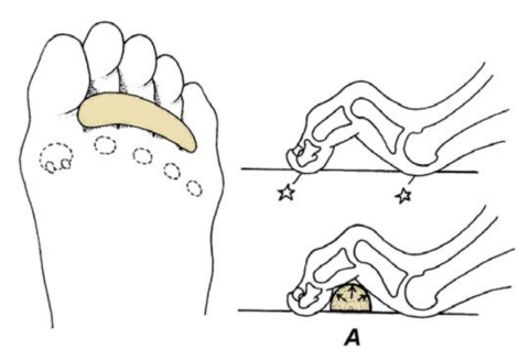 The Human Locomotion Fall Prevention Protocol - How to Create a ...