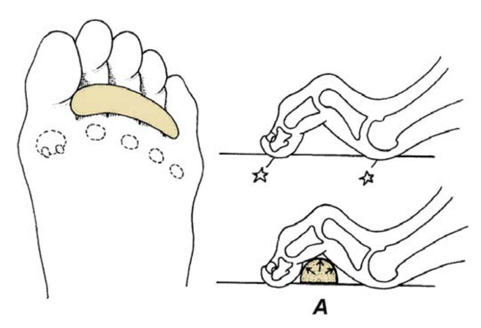 The Human Locomotion Fall Prevention Protocol - How to Create a ...