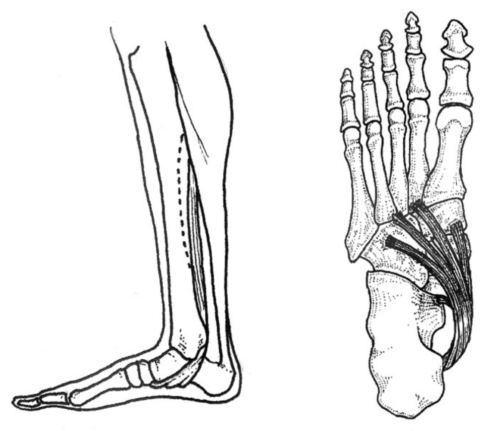 Managing Tibialis Posterior Tendon Injuries - Human Locomotion