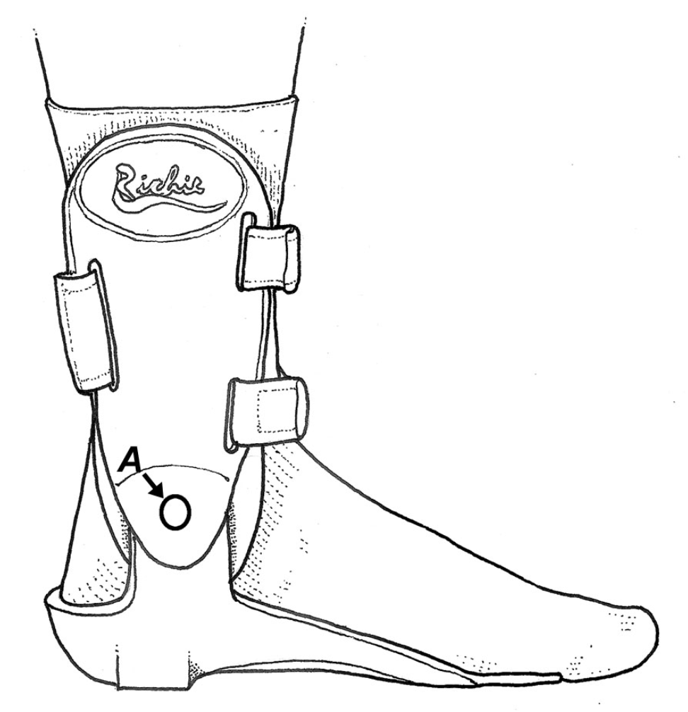 Managing Tibialis Posterior Tendon Injuries - Human Locomotion