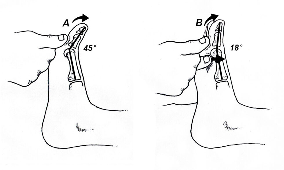 Pasapula C, Solomou G, Al-Sukaini A, Liew I, Goetz J, Cutts S ...