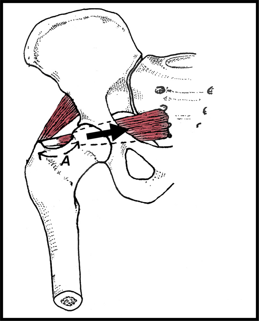 The Twist Disk: The Easiest Way to Strengthen Muscles in the Transverse ...