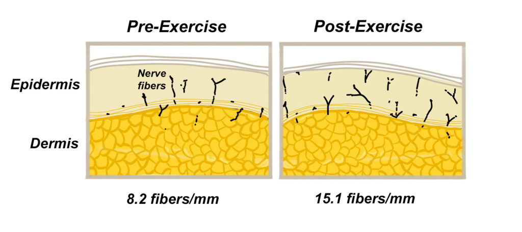Understanding Peripheral Neuropathy: Why Alternative Therapies Are ...