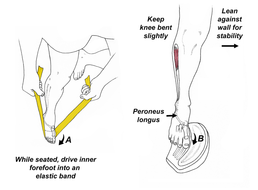 How to Prevent and Even Reverse the Formation of Bunions Without ...