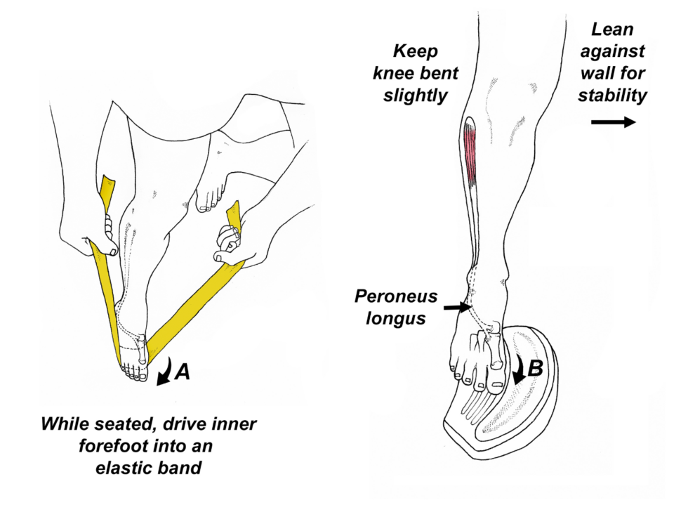How to Prevent and Even Reverse the Formation of Bunions Without ...