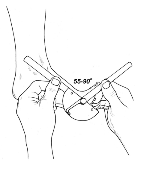 How to Prevent and Even Reverse the Formation of Bunions Without ...