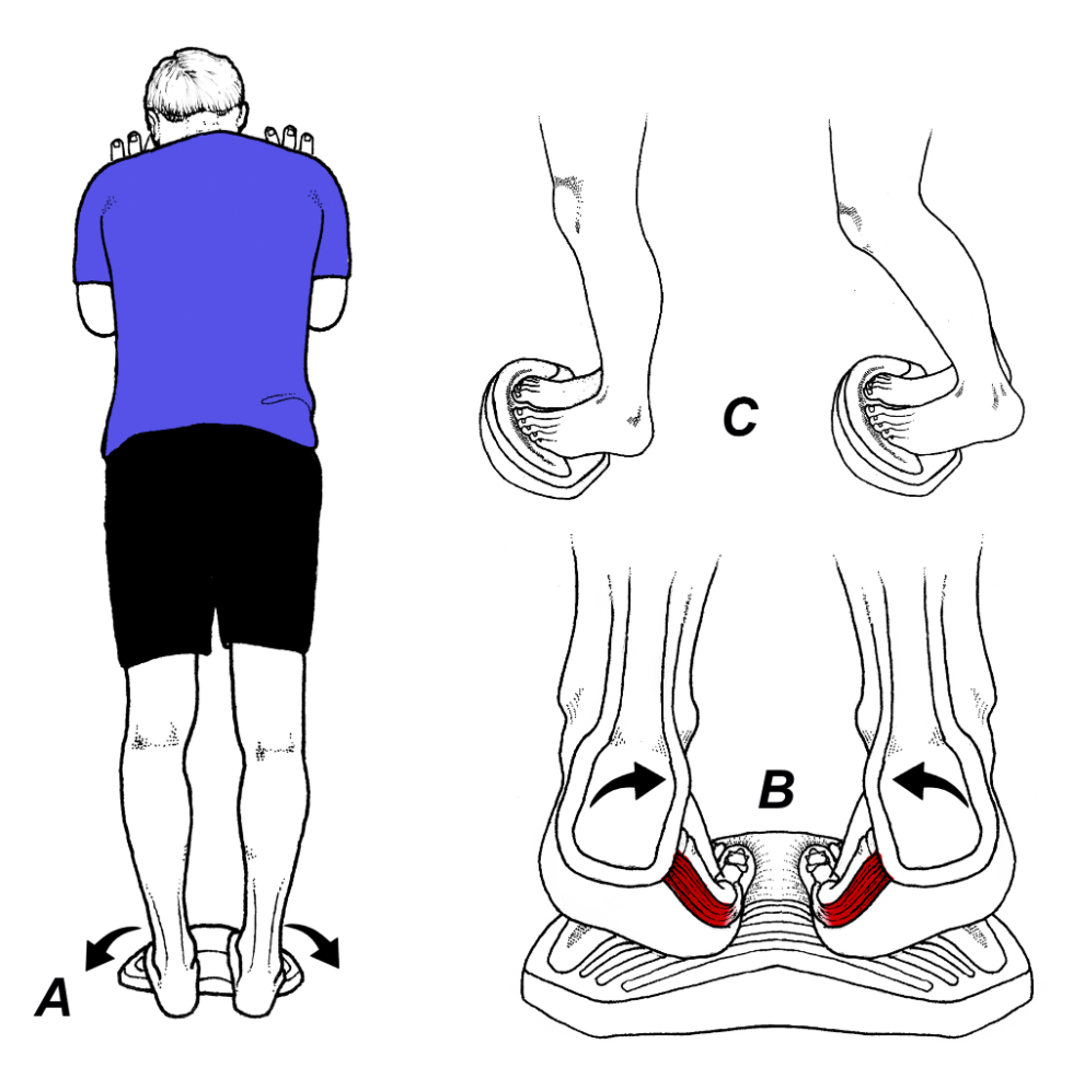 How to Prevent and Even Reverse the Formation of Bunions Without ...