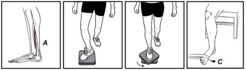 How to Prevent and Even Reverse the Formation of Bunions Without ...