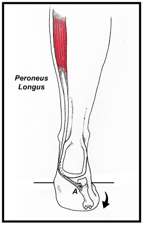 How to Prevent and Even Reverse the Formation of Bunions Without ...