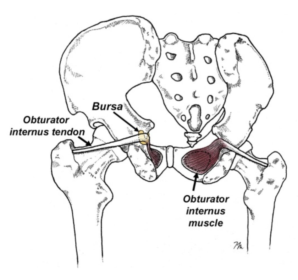 Obturator Internus Contracture: An underappreciated cause of pelvic floor and sciatic pain ...