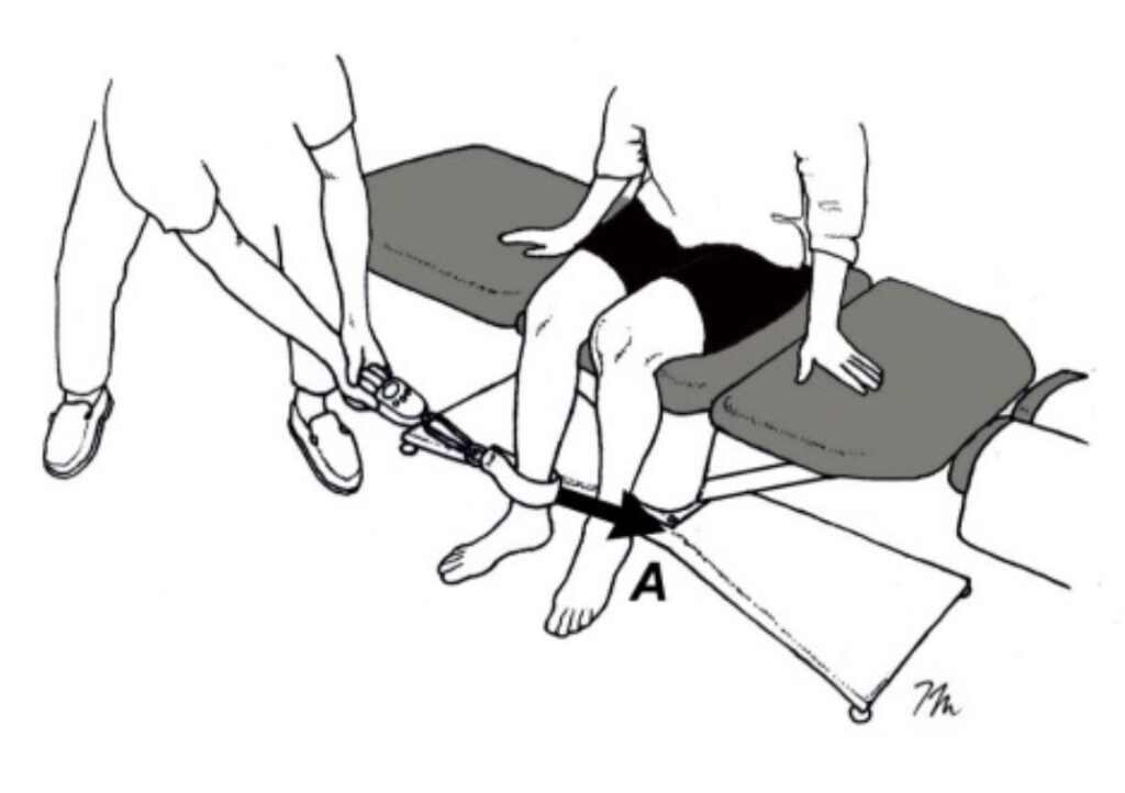 Obturator Internus Contracture: An underappreciated cause of pelvic ...