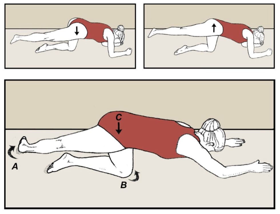 Obturator Internus Contracture: An underappreciated cause of pelvic ...