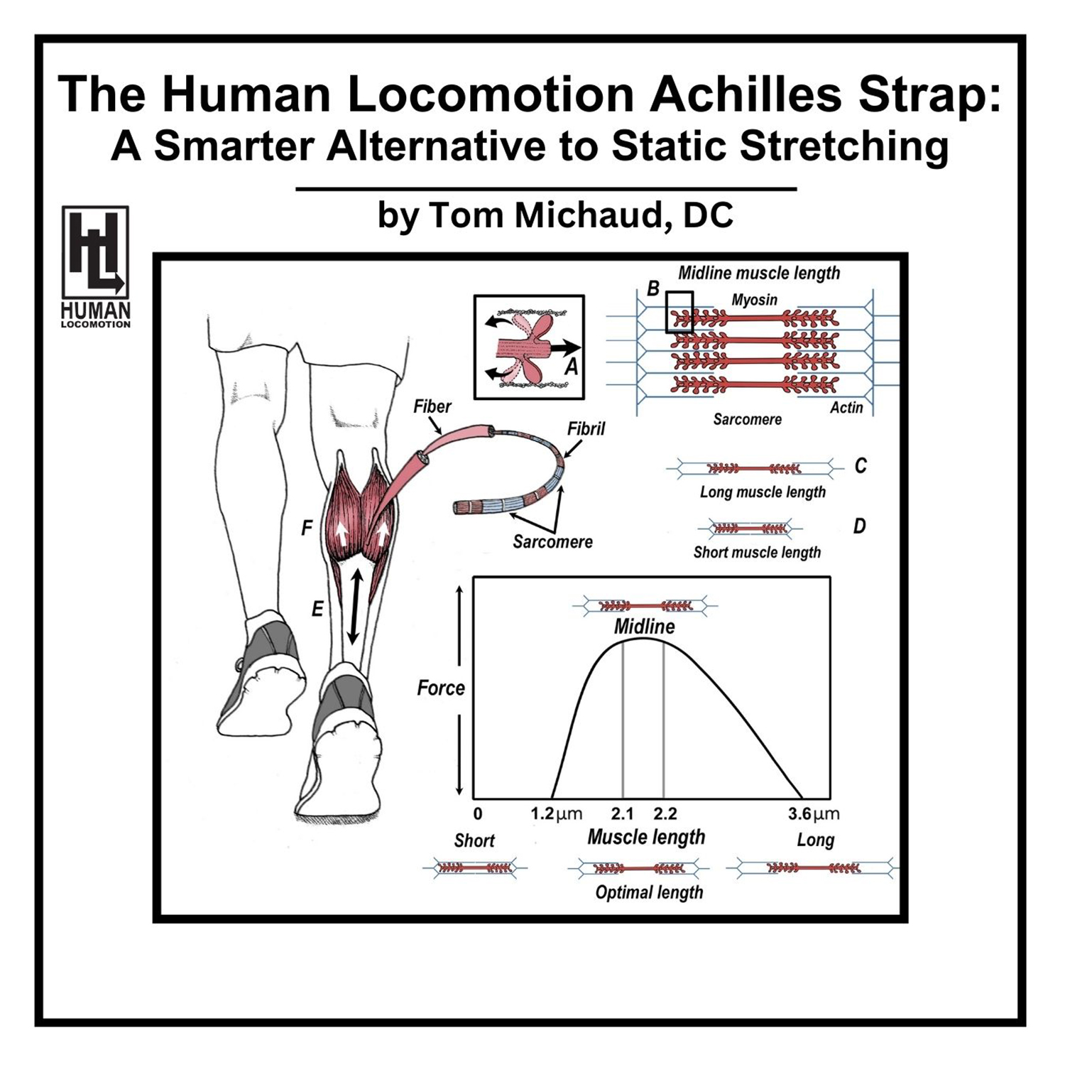 The Human Locomotion Achilles Strap: A Smarter Alternative to Static ...