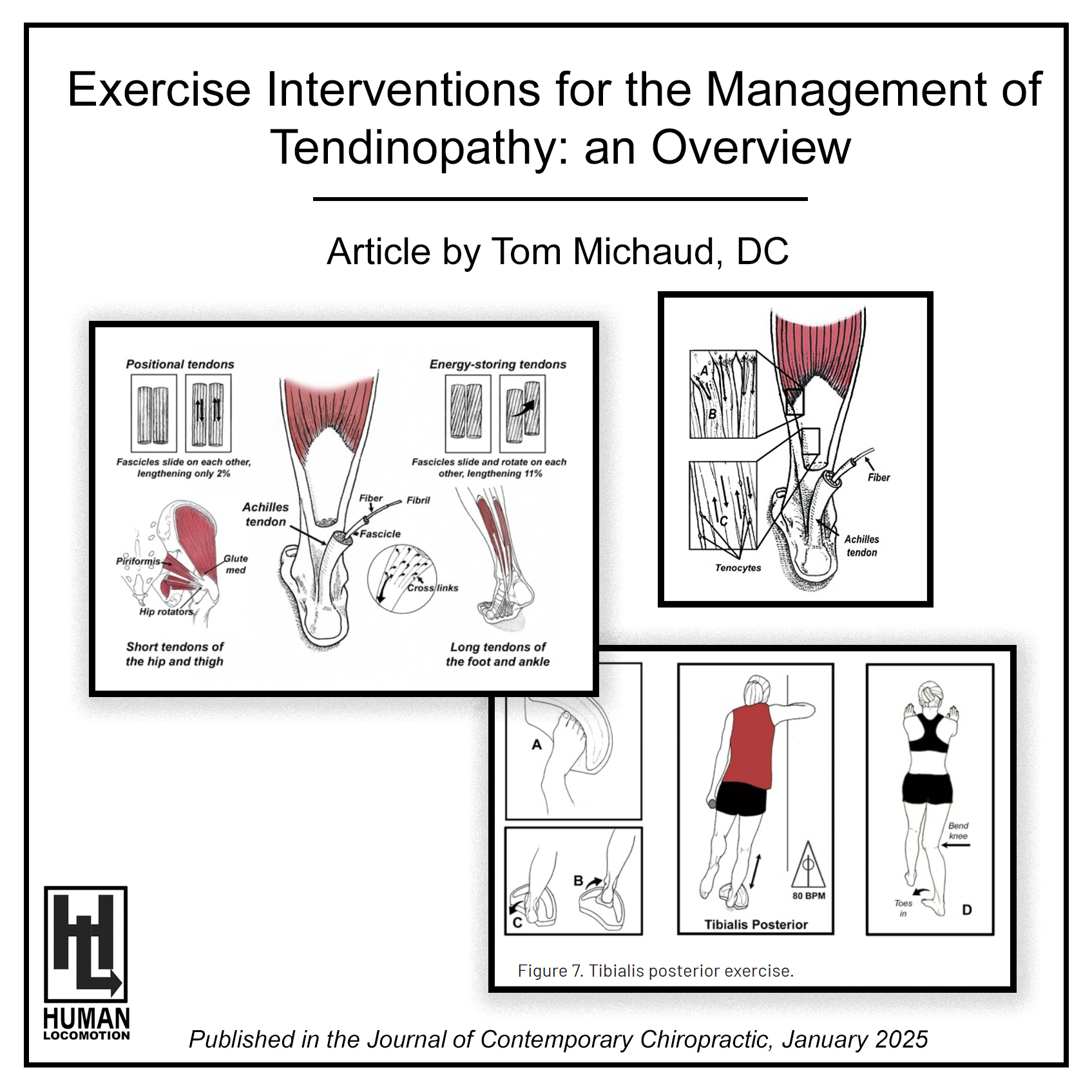 Exercise Interventions for the Management of Tendinopathy: An Overview ...