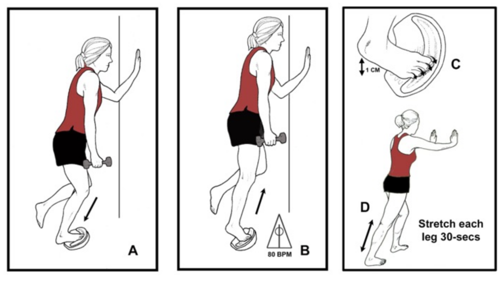 Exercise Interventions for the Management of Tendinopathy: An Overview ...