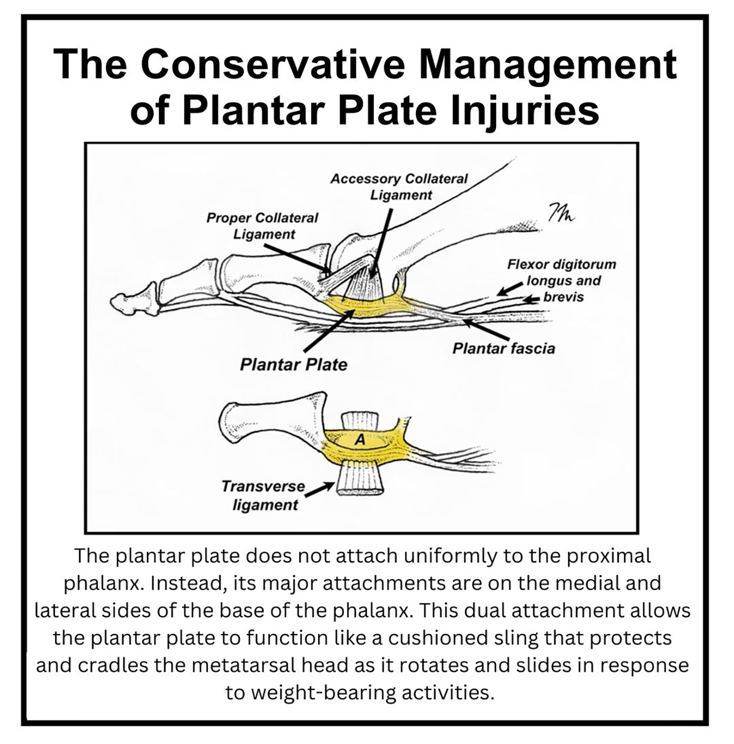 The Conservative Management of Plantar Plate Injuries - Human Locomotion
