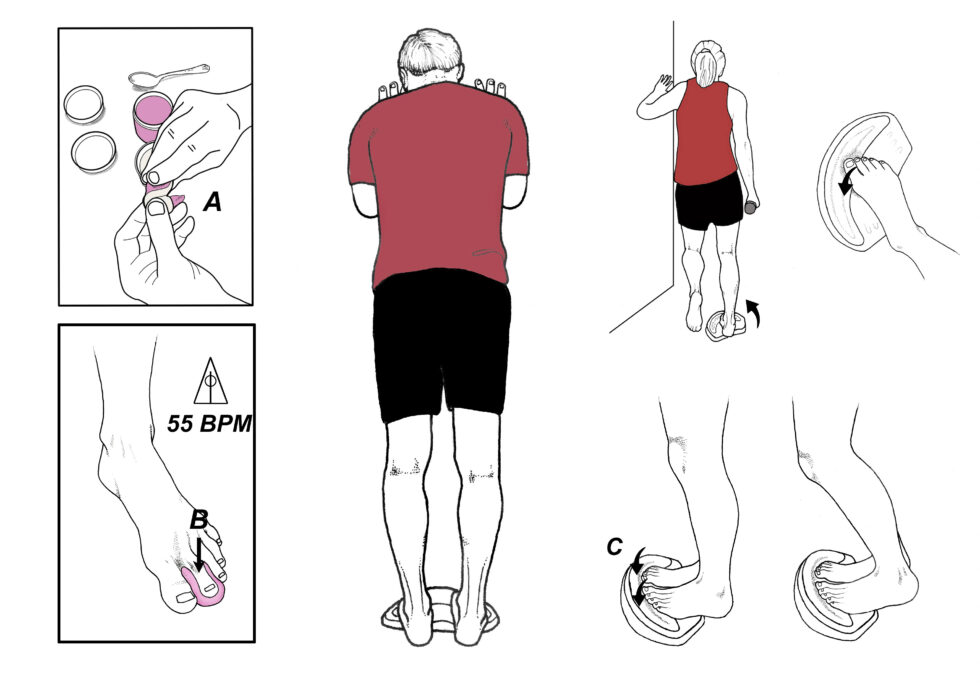 The Conservative Management of Plantar Plate Injuries - Human Locomotion