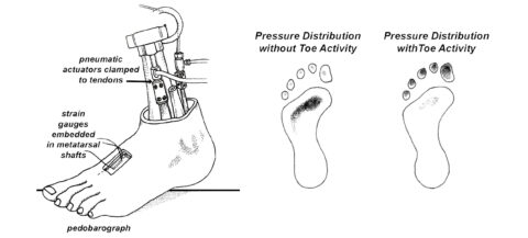 The Conservative Management of Plantar Plate Injuries - Human Locomotion