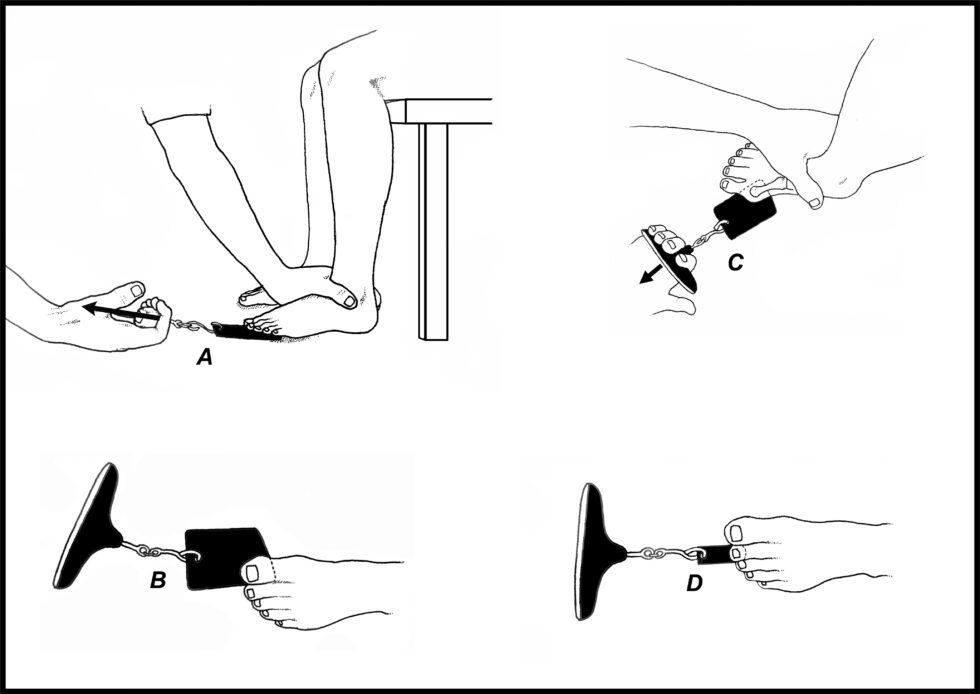 The Conservative Management of Plantar Plate Injuries - Human Locomotion